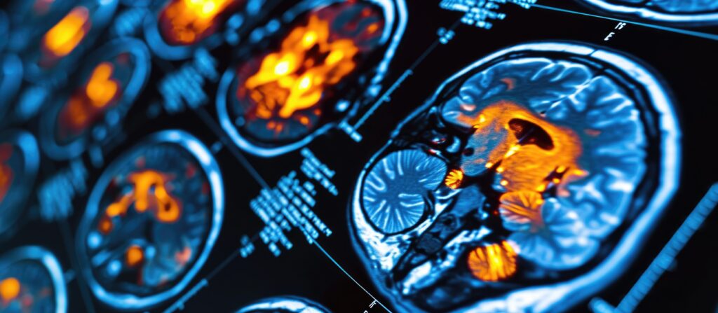 MRI Ancillary Revenue MRI High performing investments - MRI Consulting ...